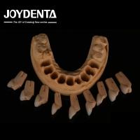 China Precise Fit Dental Feldspathic Veneer Highly Natural With Glossy Surface Texture for sale