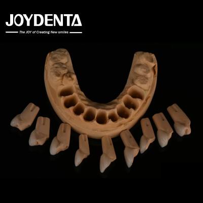 China Precise Fit Dental Feldspathic Veneer Highly Natural With Glossy Surface Texture for sale