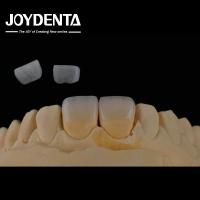 China Long Lasting Dental Feldspathic Veneer Natural Tooth Color Translucent Appearance for sale