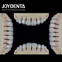 China Ultra Thin Feldspathic Veneer 0.3-0.5mm Thickness High Stain Resistance Precise Fit for sale