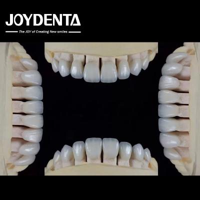 China Ultra Thin Feldspathic Veneer 0.3-0.5mm Thickness High Stain Resistance Precise Fit for sale