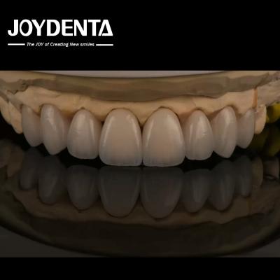 China Feldspathic Natural Looking Cosmetic Veneers Precise Fit Highly Translucent for sale