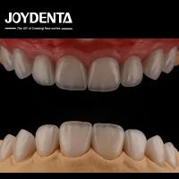China High Translucency Feldspathic Veneer , Cosmetic Porcelain Veneers With Strong Adhesion for sale