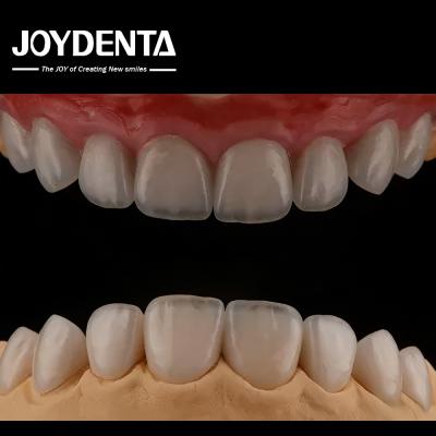 China High Translucency Feldspathic Veneer , Cosmetic Porcelain Veneers With Strong Adhesion for sale