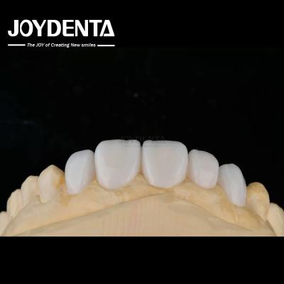 China Customization Porcelain Material Emax Teeth Veneers For High Aesthetics Bonding for sale