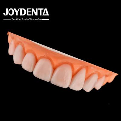 China Custom Made IPS Porcelain Emax Veneers Dental Restorations Chipping Resistant for sale