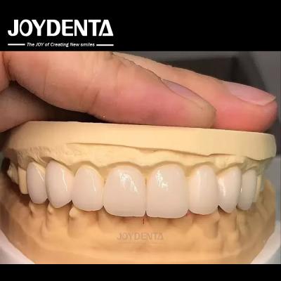 China 16 Shades Color Emax Dental Veneers A1-A4 High Stain Resistance For Perfectly Smiles for sale