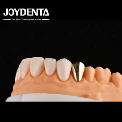 China Ultra Thin IPS Emax Press Veneers Cosmetic Teeth Veneers For Anterior Posterior Restorations for sale