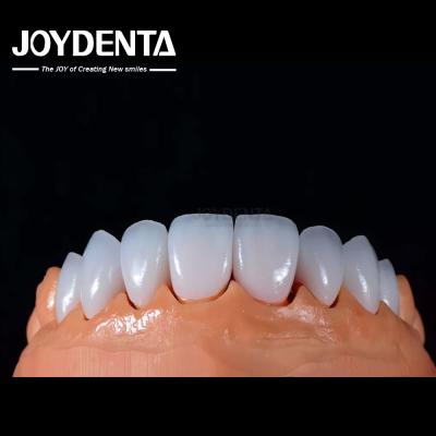 China A1-A4 Ips Emax Press Porcelain Dental Veneers Stain Resistant Customizable Shape for sale