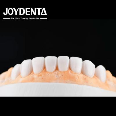 China Enhance Case Acceptance & Patient Communication with Our Diagnostic Wax-Up Service for sale