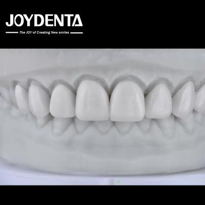 China Visualize the Result, Secure the Case: Our Diagnostic Wax-Up Service for sale