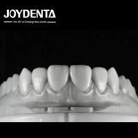 China Natural Color Dental Wax Up Versatile Solution for Single or Multiple Teeth Restoration for sale