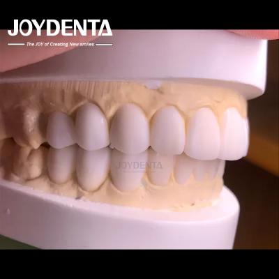 China Customized Digital Diagnostic Wax Ups for Natural Tooth Anatomy Replication for sale