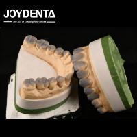 China Highly Accurate Temporary Dental Diagnostic Wax Up Customized 1-2mm Thickness for sale