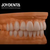 China Smooth Replicated Diagnostic Wax Up FDA , Full Arch Teeth Wax Up Highly Accurate for sale