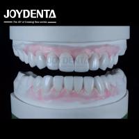 China Highly Accurate Dental Restorations Wax Up In Dentistry 1-2mm Thickness for sale