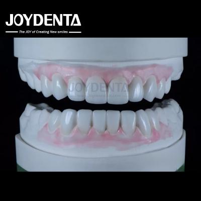 China Highly Accurate Dental Restorations Wax Up In Dentistry 1-2mm Thickness for sale