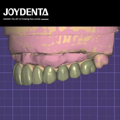 China HIPAA Compliant Data Security Digital Wax Up 3D Model For Dental Modifications for sale