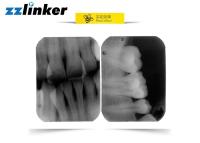 China Medical 30KHz 0.1MA 60KV RVG Digital Dental X Ray Machine Portable High Frequency Imaging for sale