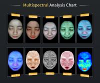 China Facial Analysis Machine for Dermatology Clinic  Medical Grade Skin Diagnostic Device with 8 Spectral Lights, CE Certified for sale