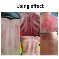 China Cordless Electric Scraping Cupping Massager 1200mAh 6 Intensity Levels Full Body Slimming Gua Sha Machine for sale