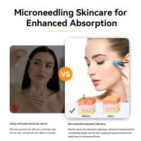 China Wireless Electric Microneedle Derma Pen with Adjustable Depth for Skin Firmness and Nutrient Absorption for sale