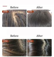 China Adults Anti Hair Loss Growth Shampoo Herbal Organic Hair Care Private Label Ginger Shampoo for sale