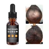 China Anti Loss And Hair Regrowth Hair Oil Treatment With Natural Ginger Extract 30ml Customized for sale