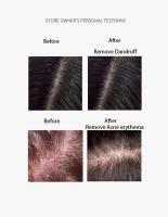 China Gel Form Sea Salt Shampoo Cream for Clearing Hair Anti-Dandruff Anti-Itch Oil Control for sale