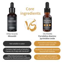 China Customization Hair Growth Treatment Serum for Black Women Private Label for sale