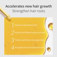 China Customization Hair Growth Treatment Serum for Black Women Private Label for sale