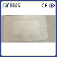China PU Transparent Membrane Dressing Transmeable Disposable Medical Consumables for sale