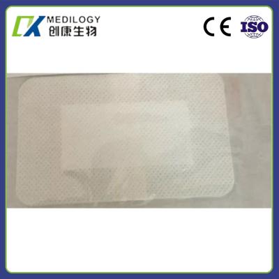 China PU Transparent Membrane Dressing Transmeable Disposable Medical Consumables for sale
