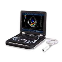 China Portable Digital Color Ultrasound Diagnostic System Diagnostic Ultrasound System for sale