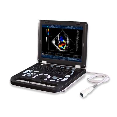 China Portable Digital Color Ultrasound Diagnostic System Diagnostic Ultrasound System for sale