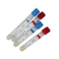 China PRP Tube 10ml 15ml 13ml PRP PRF Tube for sale