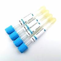China High Quality PRP Tube 10ml 15ml 13ml PRP PRF Tube for sale