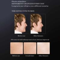 China Commercial Non Invasive Skin Rejuvenation Machine , Stand Alone Skin Tightening Machine for sale