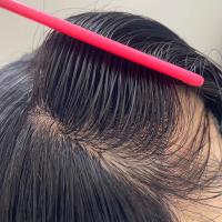 China Think Skin Injected 100% Human Hair Toupee for Men 2022 Innovative Fashionable Product for sale
