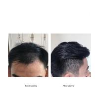 China Full Hand Made Slicked Back Style Hairline 100% Human Hair Replacement Toupee for Men for sale