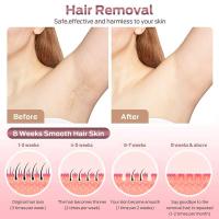 China 2000W Diode Laser Hair Removal Device 4 Wavelengths 808nm 755nm 940nm 1064nm for sale