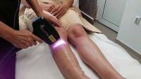 China KM300d Weifang KM 1000w 1200w 3 Wavelengths Diode Laser 755/808/1064nm With USB Update for sale