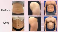 China Beauty Salon EMS Slimming Machine Desktop Type For Weight Loss / Skin Tightening for sale