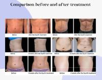 China 600w 5 Handles EMS Sculpting Machine For Neo RF 14 Tesla Bodi Sculpting Body Slimming for sale
