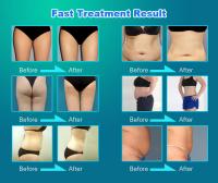 China Vacuum Cellulite Fat Removal Machine , Vibration Slimming Machine 3500W for sale