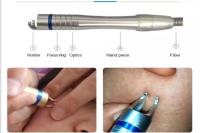 China 15W 30W Laser Vascular Removal machine for Toenail Treatment / Hot Laser Skin Rejuvenation for sale