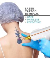 China Skin Whitening Nail Fungus Laser Treatment Machine 1064nm 532nm 1320nm Wavelengths for sale