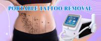 China Medical Nd YAG Hair Removal Machine 1064nm 532nm Laser Tattoo Removal Equipment for sale
