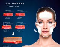 China Vertical Magnetic Facial Ems rf Skin Rejuvenation Lifting Skin Tightening slimming Rf Lifting Machine machifor sal for sale