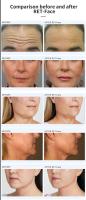 China Vertical Magnetic Facial Ems rf Skin Rejuvenation Lifting Skin Tightening slimming Rf Lifting Machine machifor sal for sale